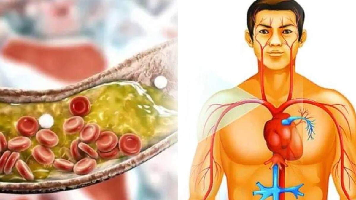 Five Liquid Food Items That Can Increase Bad Cholesterol Level In Marathi five-liquid-food-items-that-can-increase-bad-cholesterol-level-in-marathi